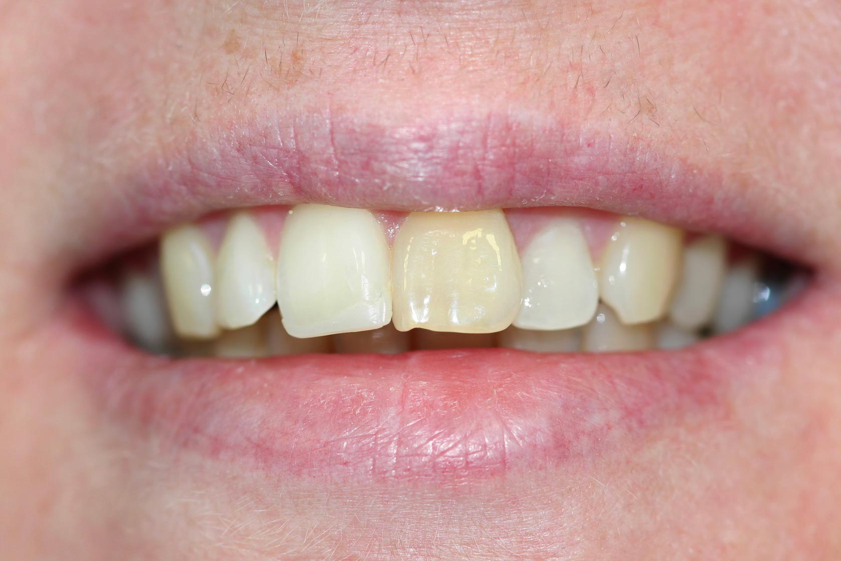 Gallery - Buchanan Dental Care