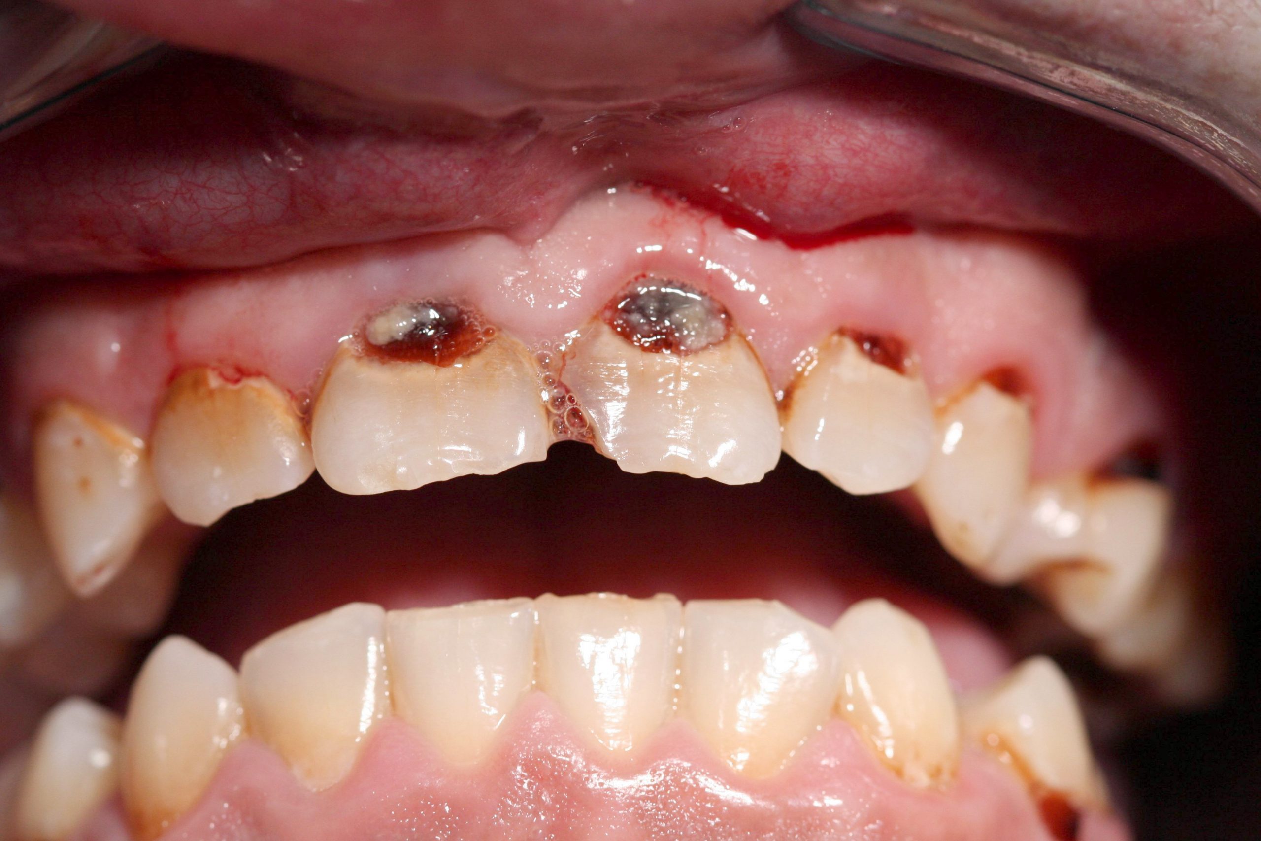Gallery - Buchanan Dental Care